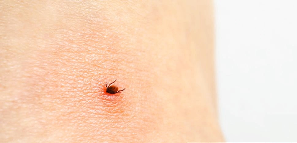 De ziekte van Lyme en elektrogevoeligheid – Stralingsleed